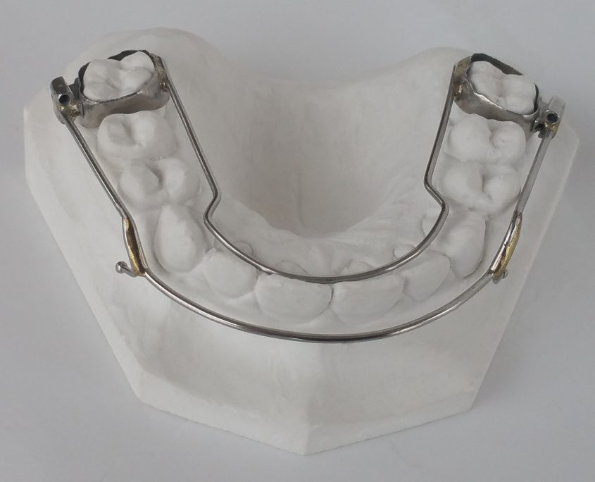 Festsitzende Geräte › KFO Fachlabor Ortho Station