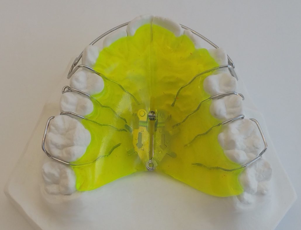 Platten und Dehnplatten › KFO Fachlabor Ortho Station