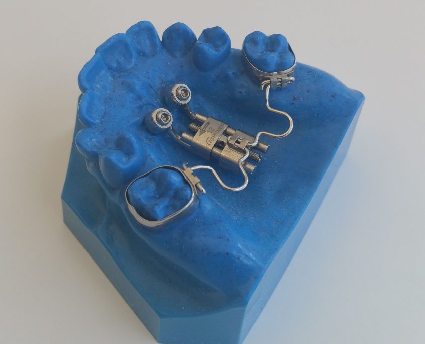 Festsitzende Geräte › KFO Fachlabor Ortho Station