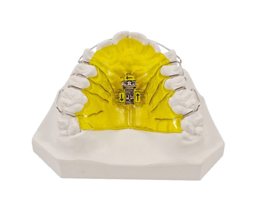 Platten und Dehnplatten › KFO Fachlabor Ortho Station