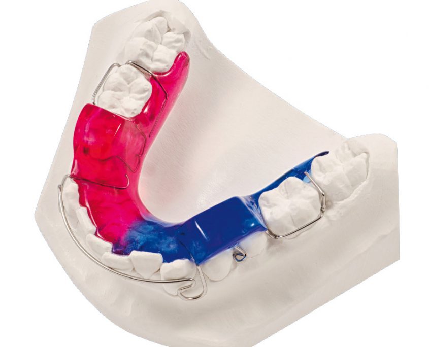 Platten und Dehnplatten › KFO Fachlabor Ortho Station