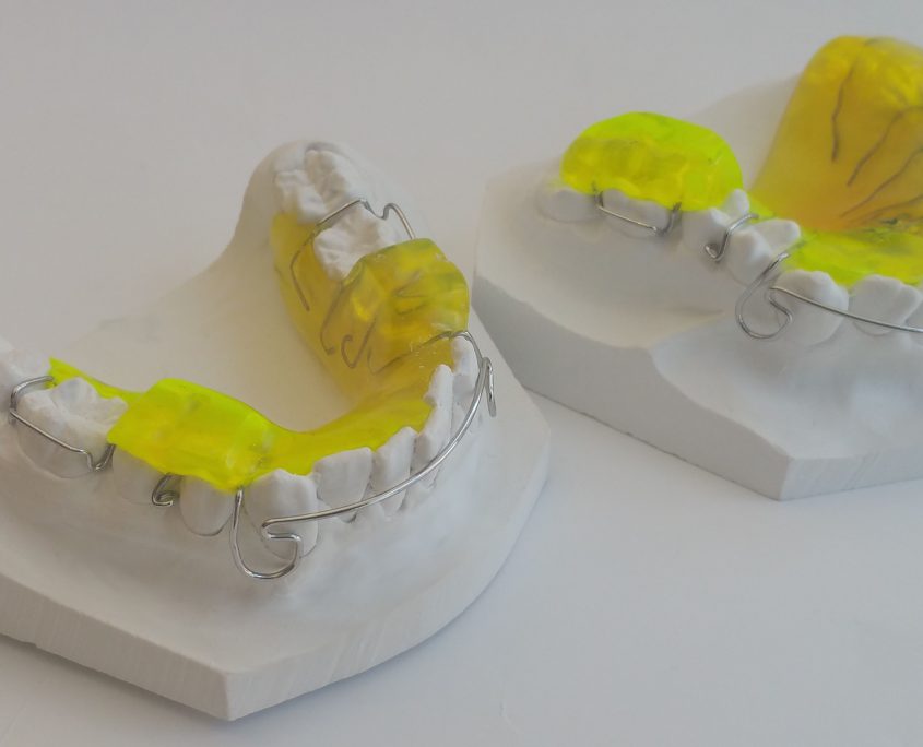 Platten und Dehnplatten › KFO Fachlabor Ortho Station